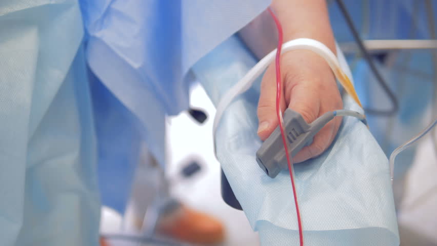 Heart Rate Monitor On Patients Stock Footage Video (100% Royalty-free ...