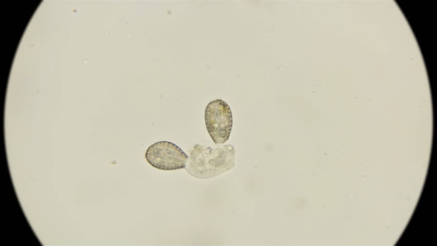 Infusoria Coleps, Class Ciliata, Tear Stock Footage Video (100% Royalty ...