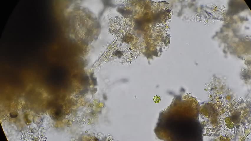 Heliozoa Or Sun Animalcule Under Microscope, Magnif 400x Stock Footage ...