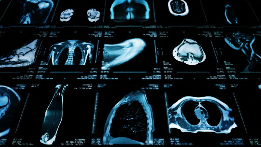 4k Blue Medical Background. Video Showing MRI, Charts, Numbers And Data ...