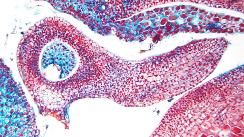 Cross-section Of Leaf Winter Jasmine Under A Microscope (Eloden Leaf C ...
