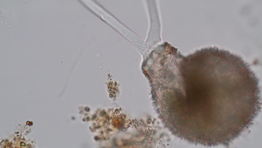 Difflugia in a Droplet Under Stock Footage Video (100% Royalty-free ...