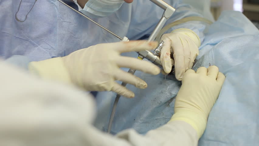 Kidney Stone Stock Video Footage - 4K and HD Video Clips | Shutterstock