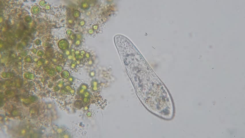 Full HD. Original Video Of Infusoria Under Microscope (phase-contrast ...