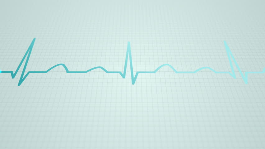 Animation Of Schematic Diagram Of Normal Sinus Rhythm For A Human Heart ...