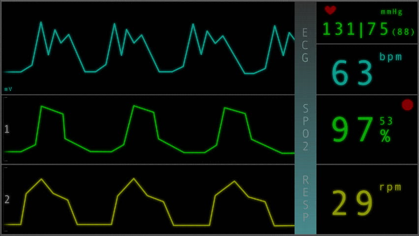 EKG ECG Monitor 4K 4096 X 2304 Ultra High Resolution Stock Footage ...
