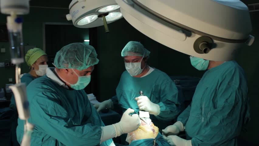 Stock video of surgeons team performing operation in hospital | 5583416 ...