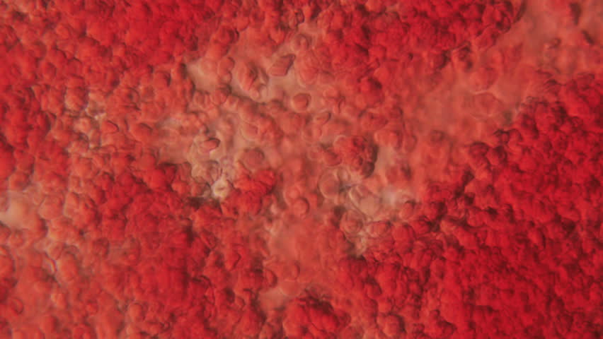 Blood Cell Channel 100x (HD 24p). Blood Platelets Seen Forming A Small ...