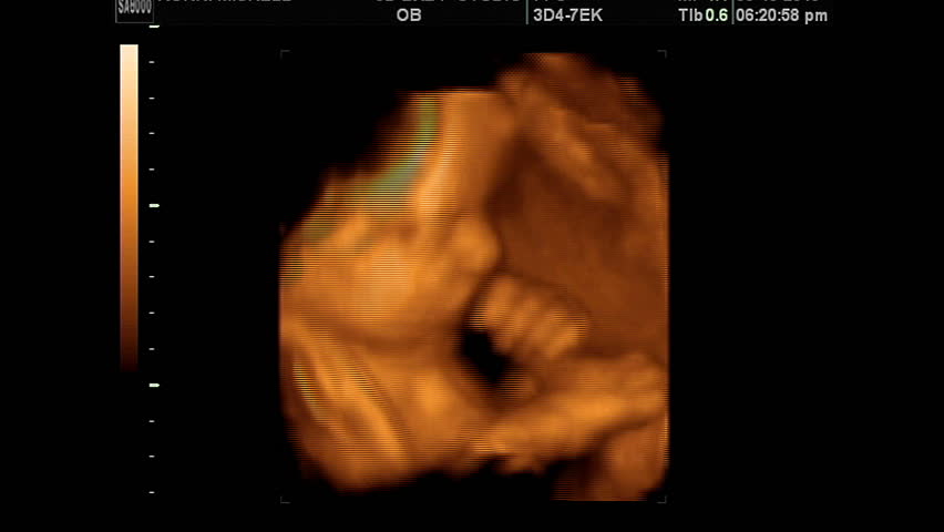 A 4D Ultrasound Of A Beautiful Baby At 30 Weeks Gestation Stock Footage ...